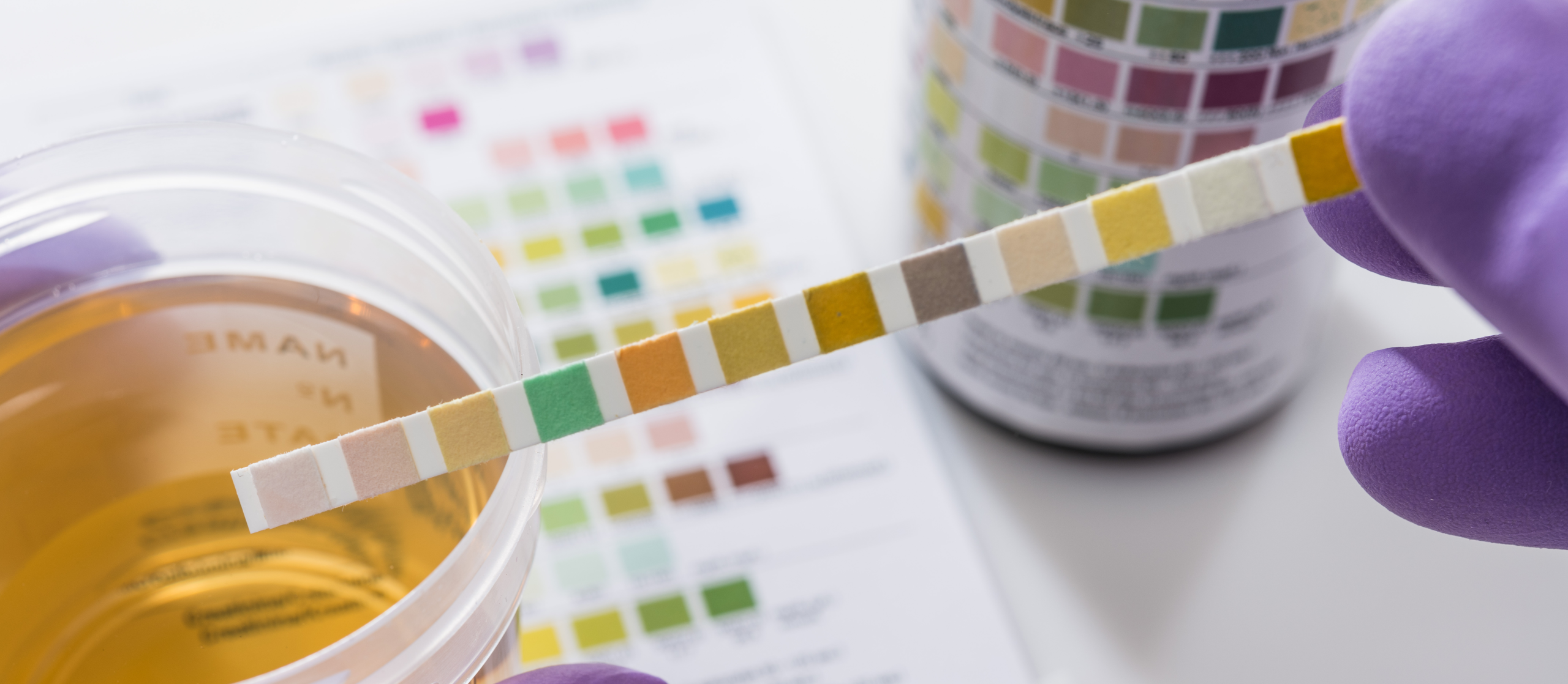 A cor da sua urina revela sinais importantes sobre sua saúde – Don Saúde