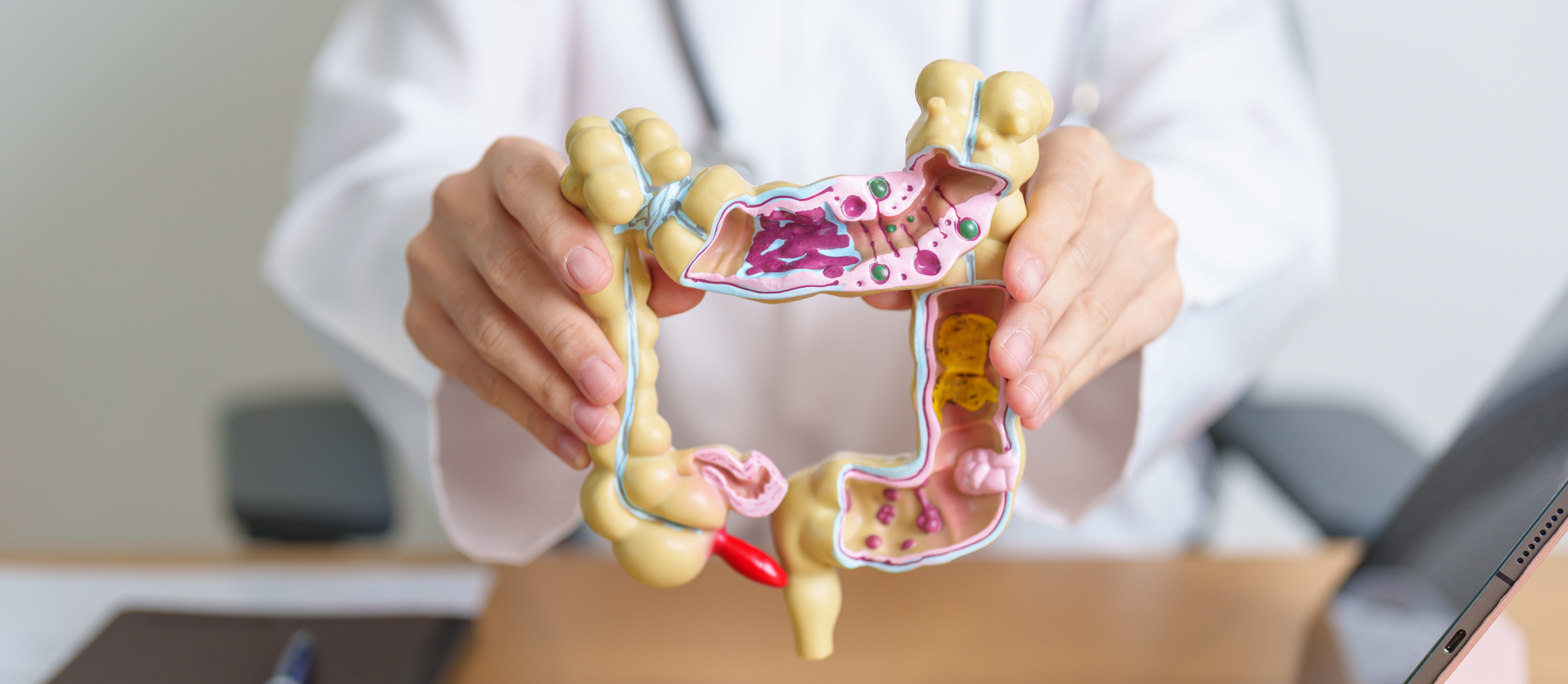 Câncer de intestino: o que você precisa saber – Don Saúde